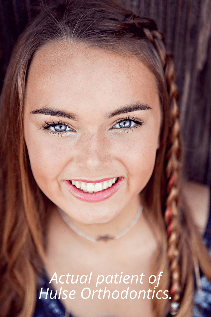 Types of Braces | Hulse Orthodontics | Carlsbad, CA