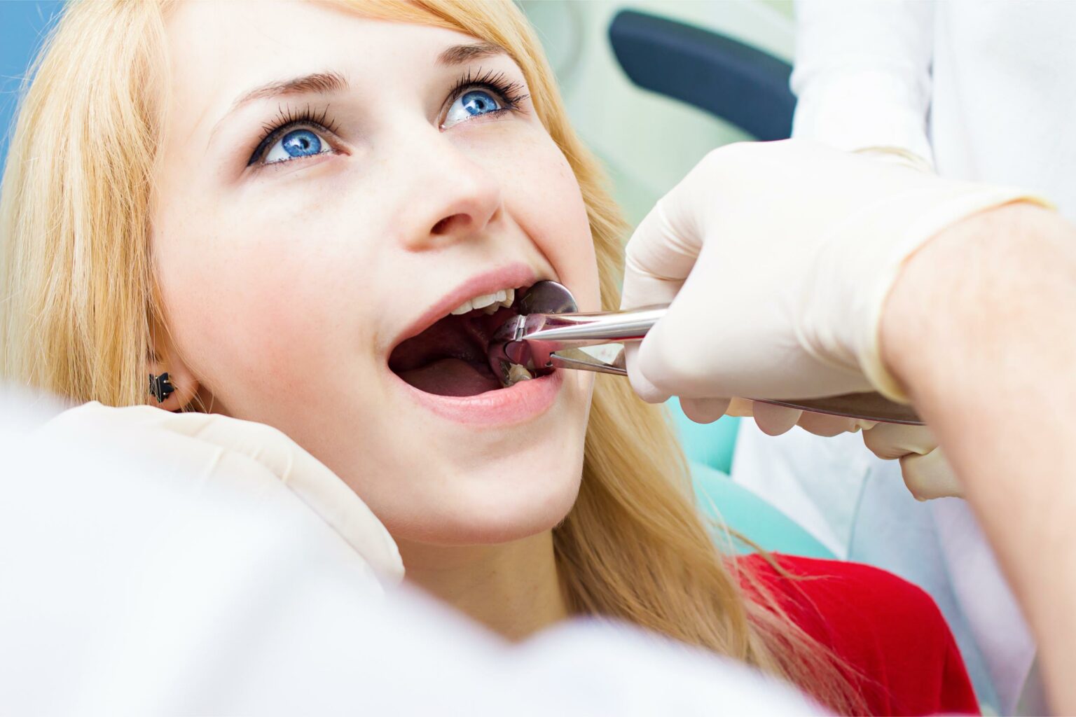 Removing Teeth For Braces - Extractions Needed?